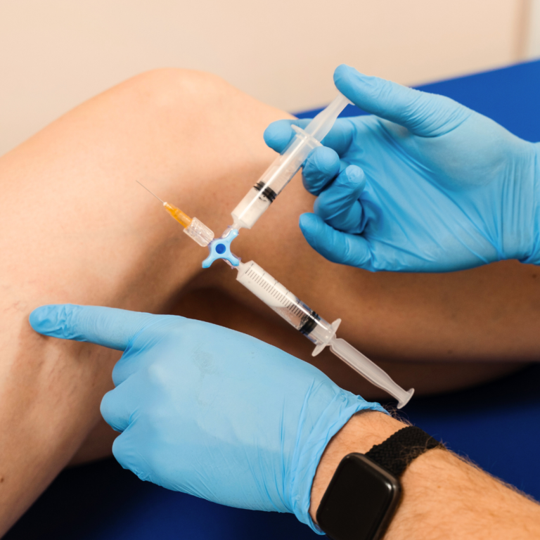 OPERACJA STULEJKI (PLASTYKA NAPLETKA) - Dr Kowalczewski